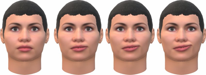 Acidente Vascular Cerebral - AVC - Sapere Sênior